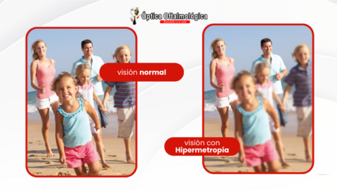 3 problemas visuales más comunes - Óptica Oftalmológica