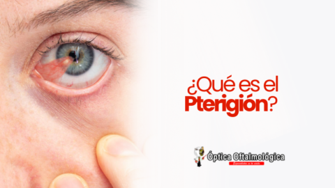 ¿Qué es el Pterigión? - Óptica Oftalmológica